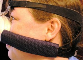 Pad a cheek for Nasal CPAP mask
